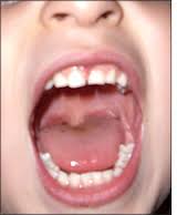 Why is my toddler biting and how to get through it